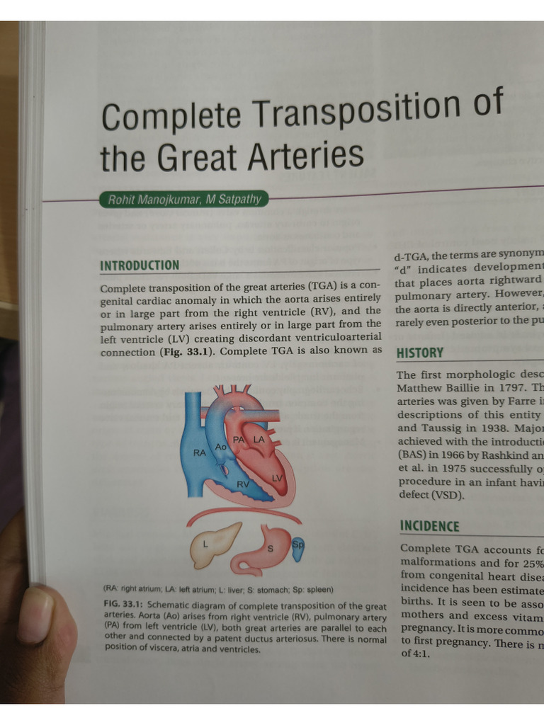 Tga | PDF