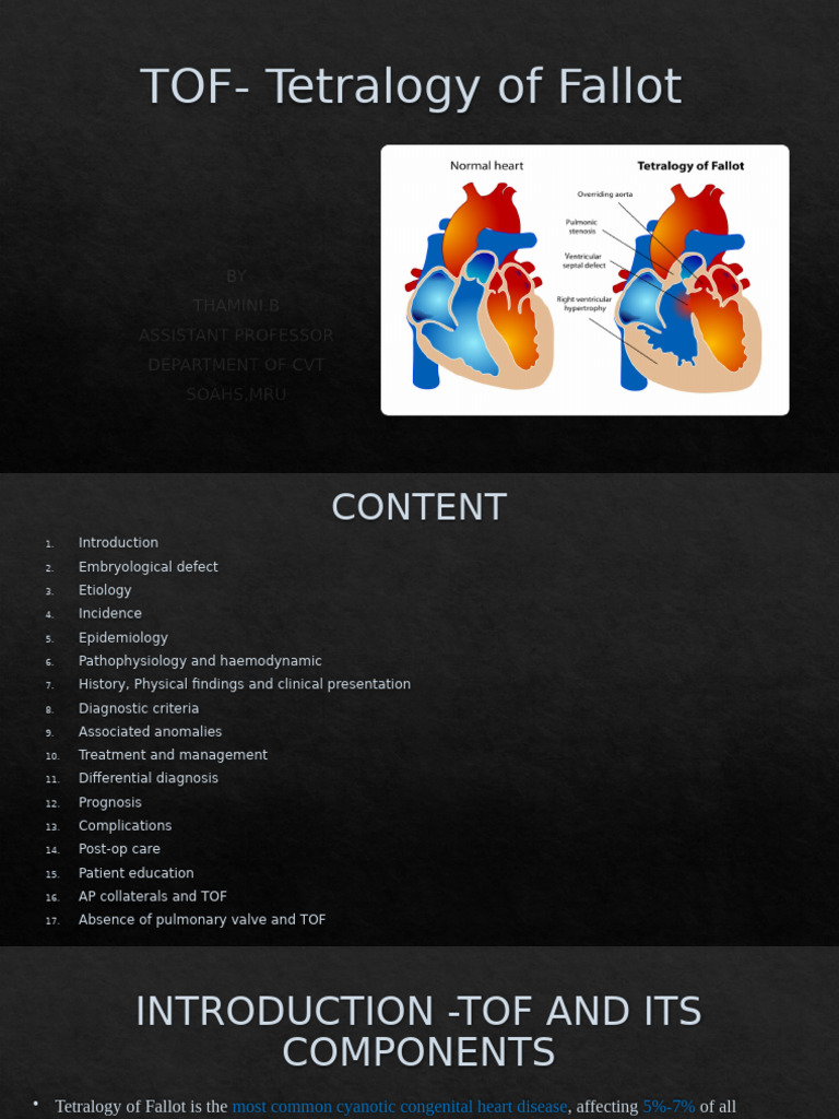 Tetralogy of Fallot | PDF | Congenital Heart Defect | Heart