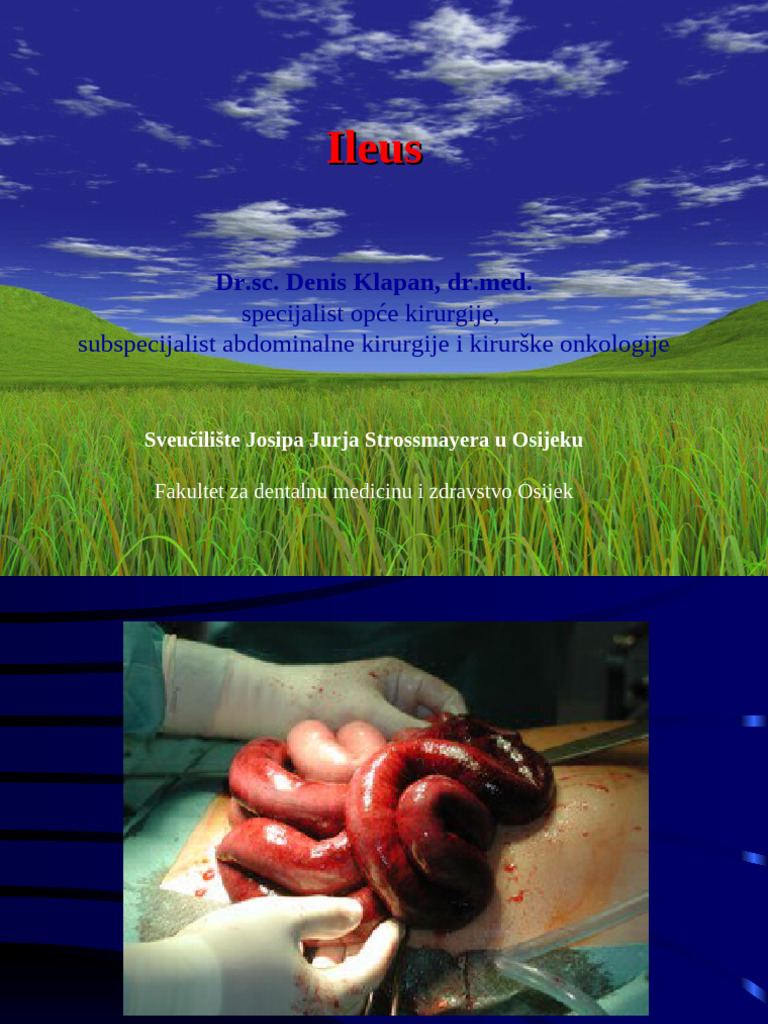 Ileus | PDF