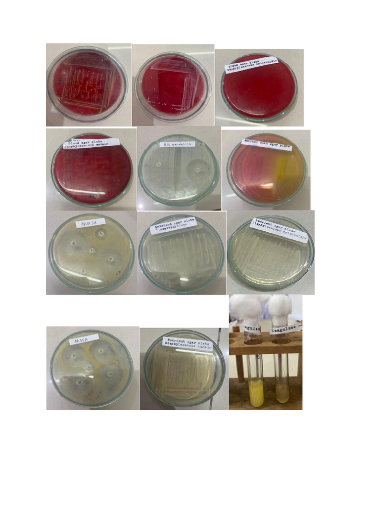 Laprak 2 Mikrobio | PDF
