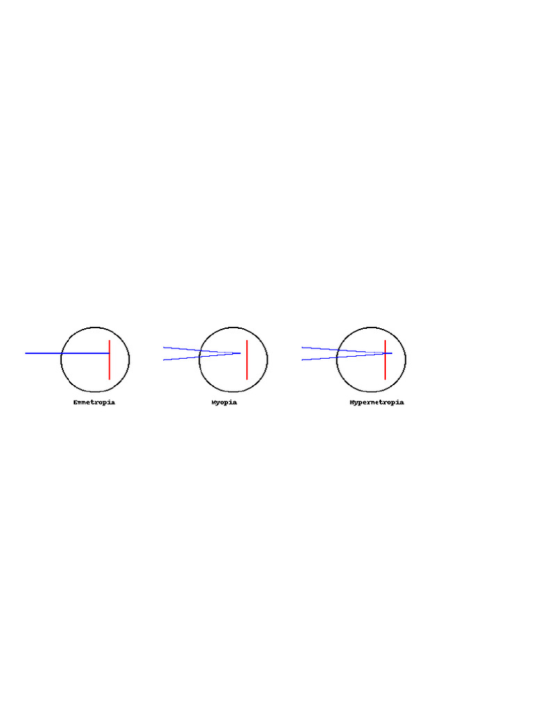 Anomalies of Refraction With Diagram | PDF
