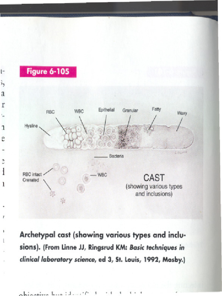 Urinary Cast | PDF