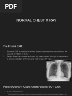 AP vs PA Chest X-Ray Differences | PDF | Radiography | Radiology
