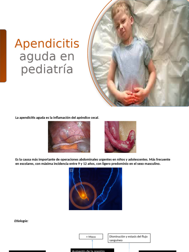 Apendicitis Aguda en Pediatría | PDF | Especialidades Medicas ...
