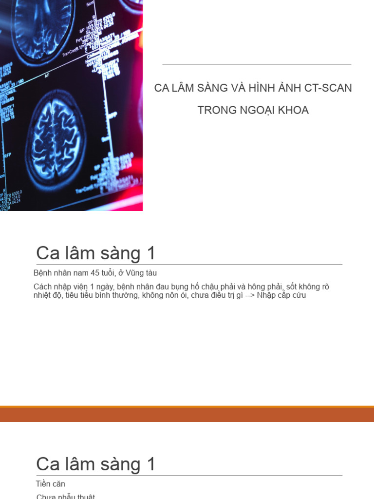 CA Lam Sang - CT Scan | PDF