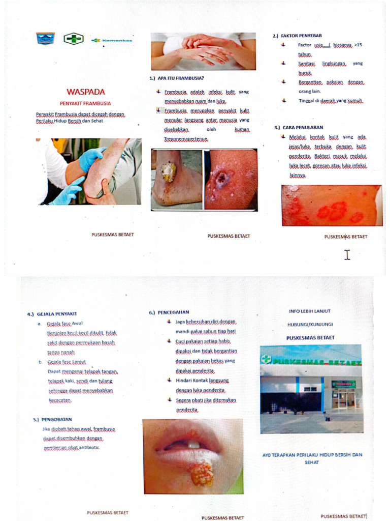 Pkm. Betaet - Leaflet Frambusia | PDF