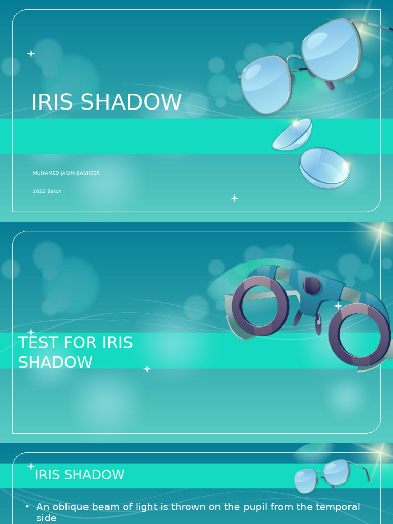 Iris Shadow in Cataract | PDF