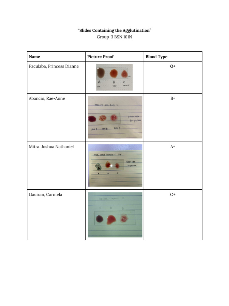 Group 3 (Agglutination Slides) | PDF