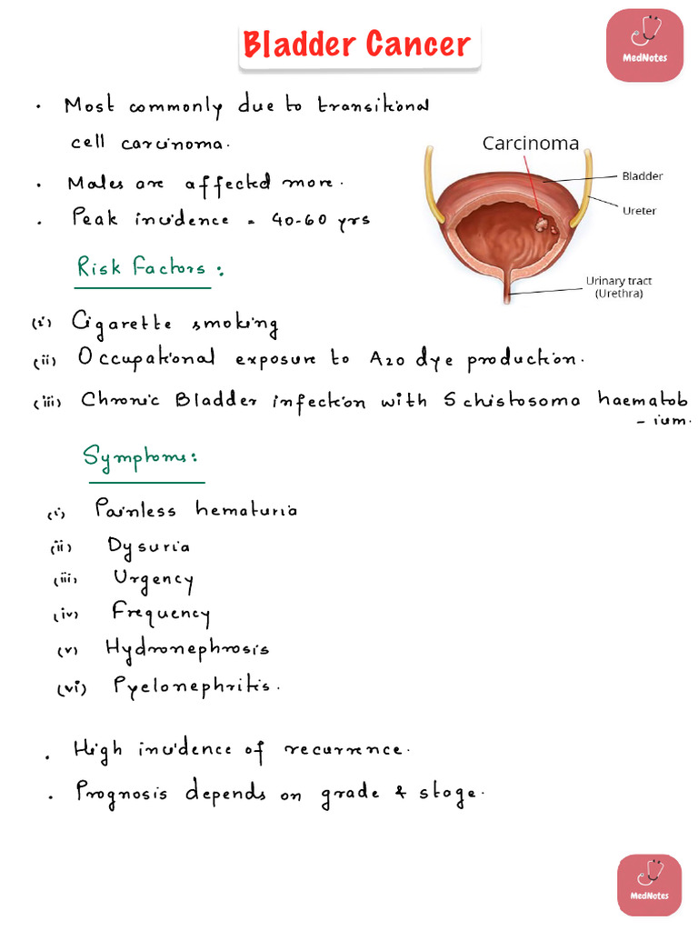 Bladder Cancer Pdf