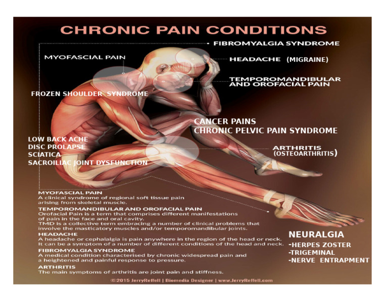 Pain Management Strategies Overview | PDF