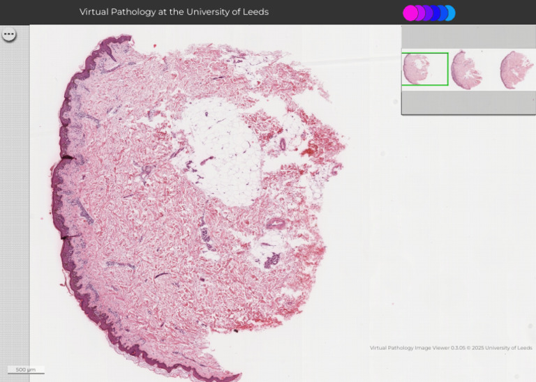 Slide Viewer Virtual Pathology at The University of Leeds | PDF