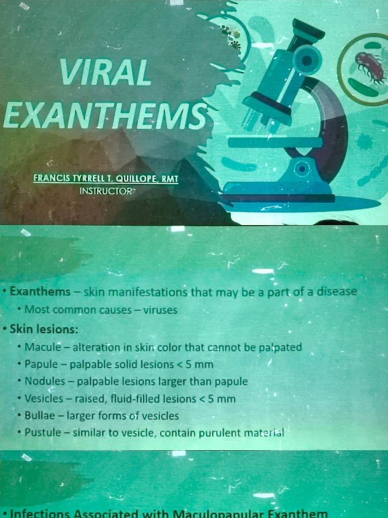 23 Viral Exanthems | PDF