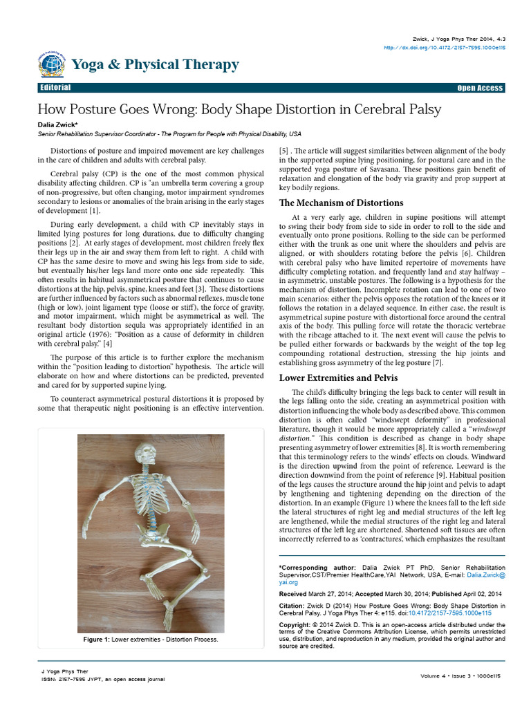 How Posture Goes Wrong Body Shape Distortion in Cerebral Palsy 2157 ...