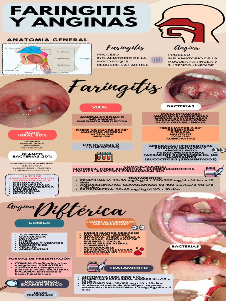 Faringitis y Anginas | PDF | Inmunología | Medicina CLINICA