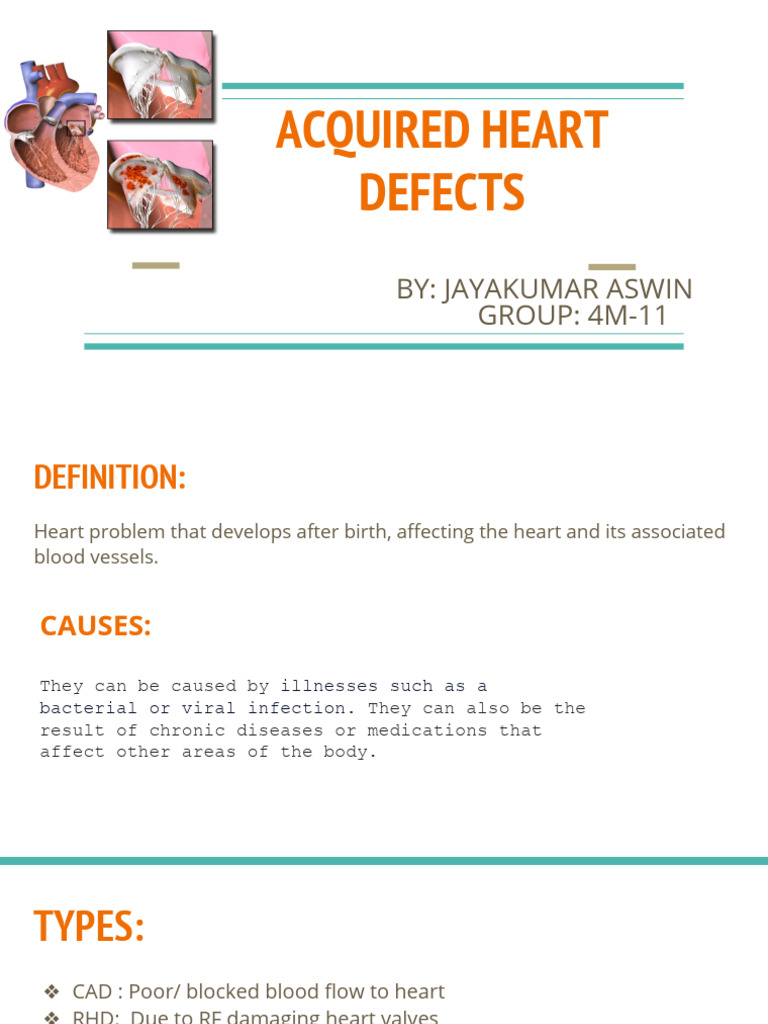 Acquired Heart Defects Aswin 4M11 | PDF
