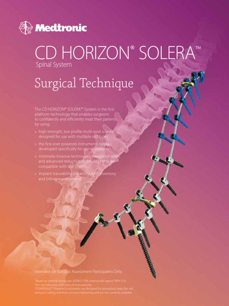 SOLERA Technique Picture | PDF | Skeletal System