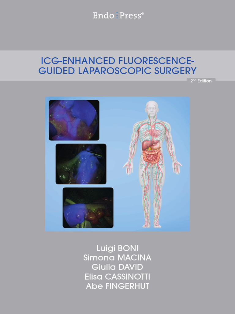 ICG-Enhanced Laparoscopic Surgery Guide | PDF