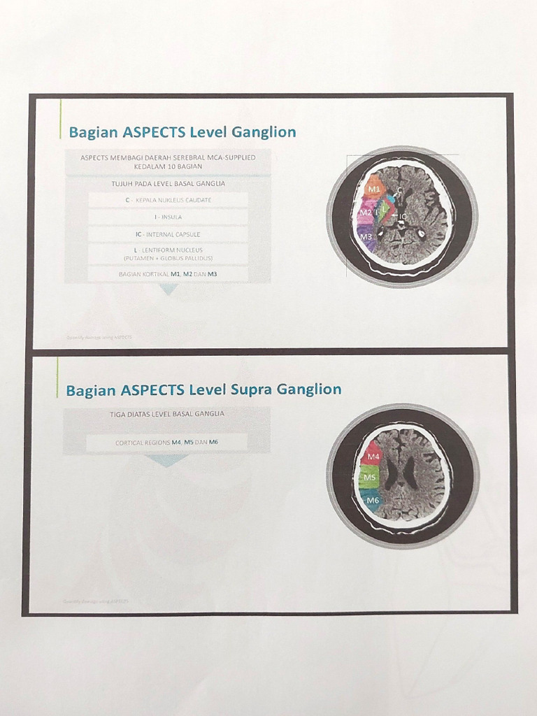 Bahan Code Stroke 08-Nov-2024 13-54-07 | PDF
