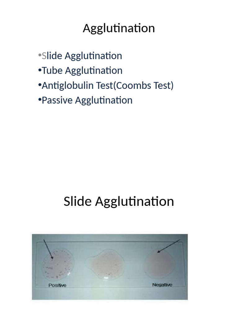 Agglutination: Lide Agglutination Tube Agglutination Antiglobulin Test ...