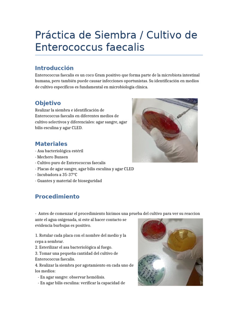 Practica Enterococcus Faecalis | PDF