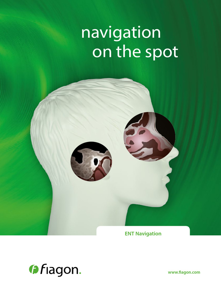 Fiagon ENT Navigation System Overview | PDF | Otorhinolaryngology ...