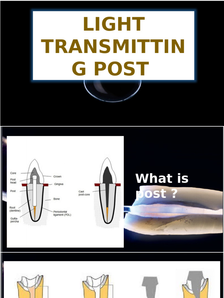 Light Transmitting Post | PDF | Fibers | Physical Sciences