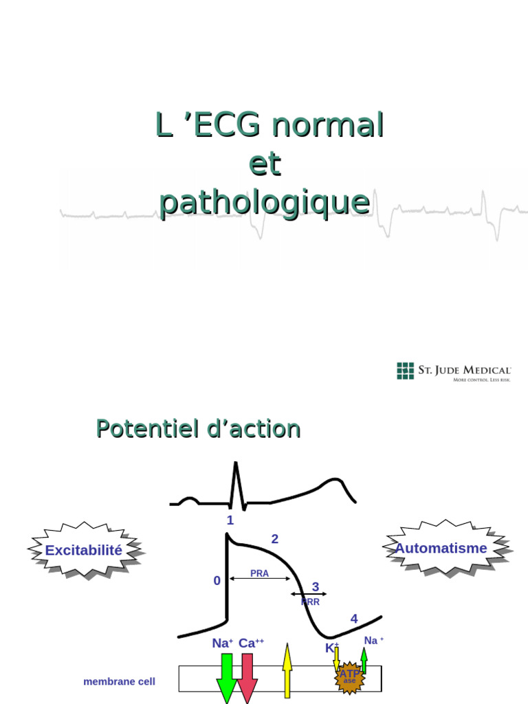 Comprendre l'ECG normal et pathologique | PDF | Électrocardiographie ...
