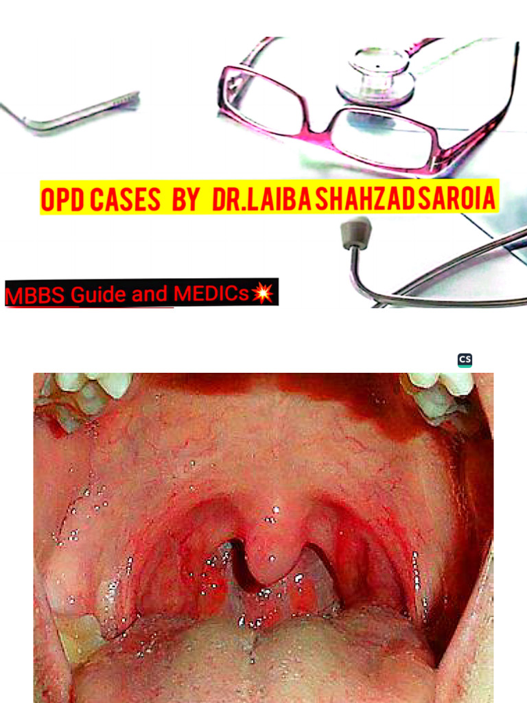 Pharyngitis | PDF