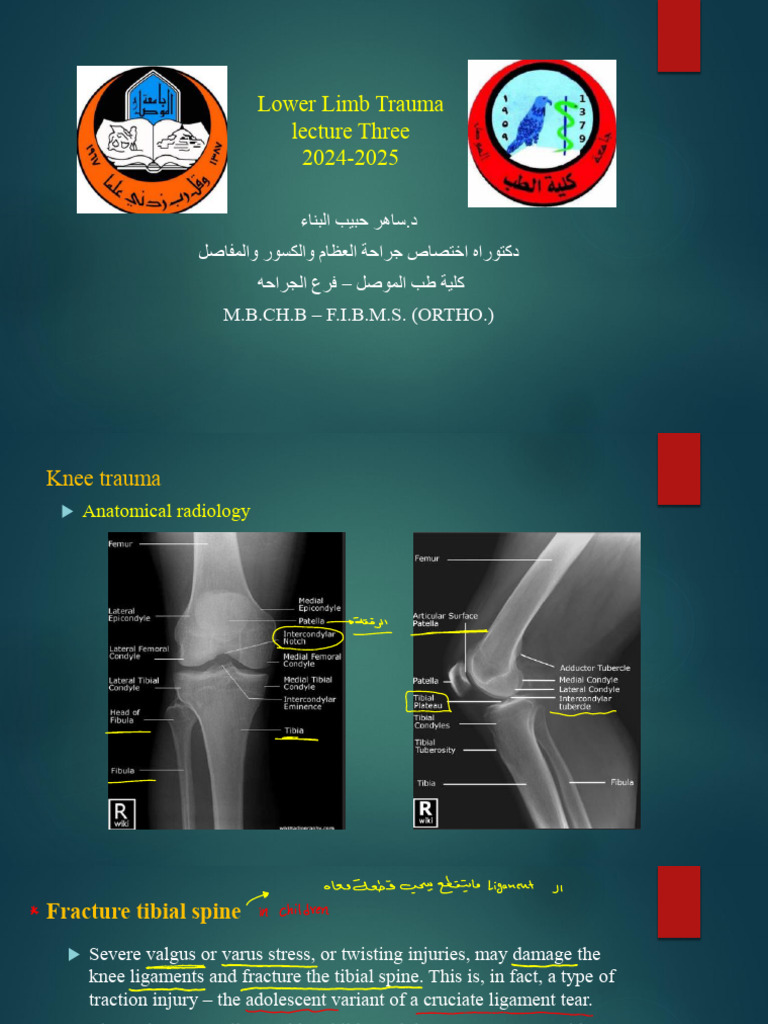 Lower Limb Trauma 3 | PDF | Knee | Musculoskeletal Disorders