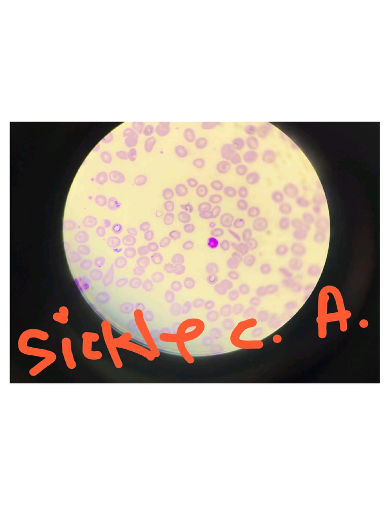 Spotting Slides | PDF