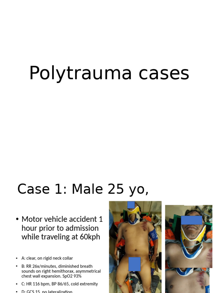 Polytrauma and Disaster Cases | PDF | Thorax | Medical Specialties