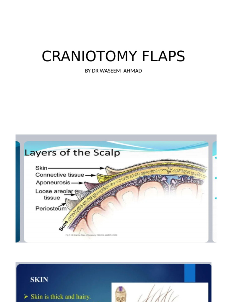 CRANIOTOMY FLAPS FVGRB | PDF | Cerebral Hemisphere | Cerebellum