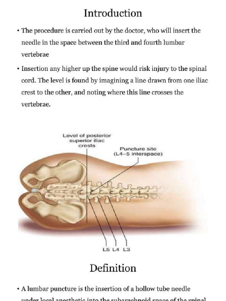 Lumbar Puncher and CSF Analysis (Invasive Diagnostic Procedure) | PDF