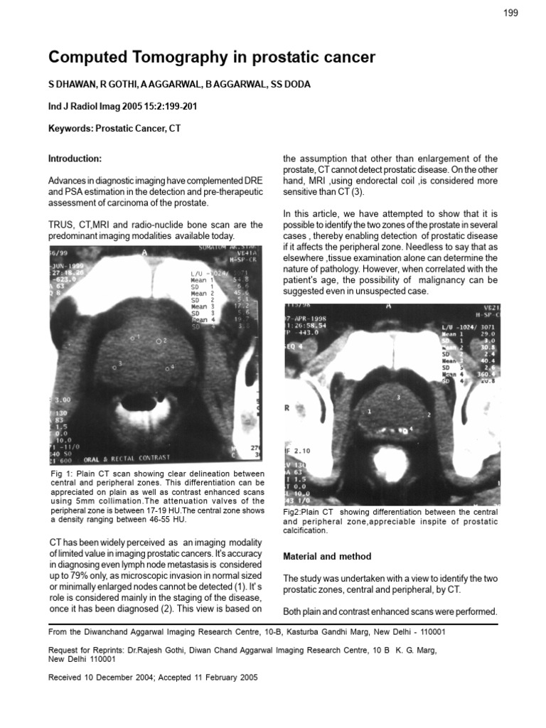 CT Imaging of Prostate Zones in Cancer | PDF | Ct Scan | Medical Imaging
