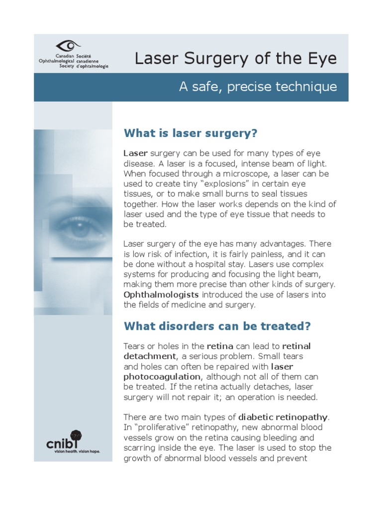 Laser Surgery of The Eye: A Safe, Precise Technique | PDF | Eye ...