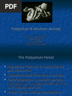 Bandl's Ring: Causes and Risks | PDF | Childbirth | Uterus