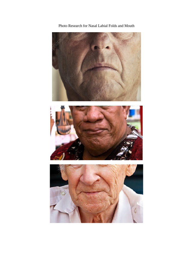 Photo Research For Nasal Labial Folds and Mouth | PDF