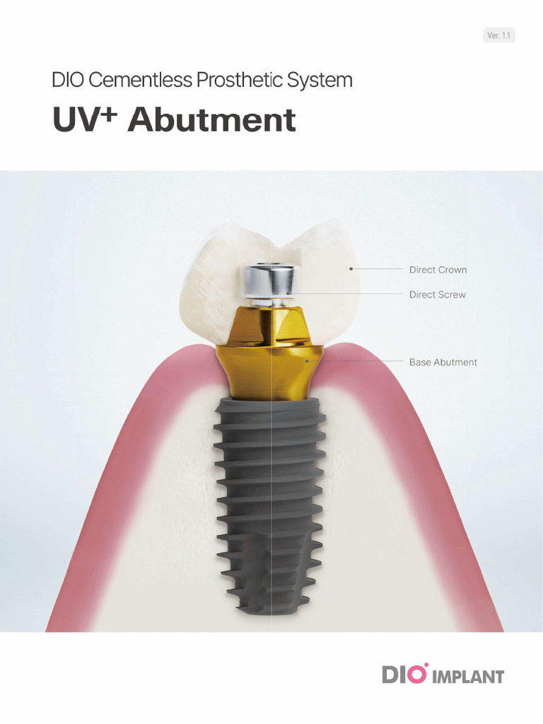 DIO UV Abutment 임상 및 브로셔 | PDF
