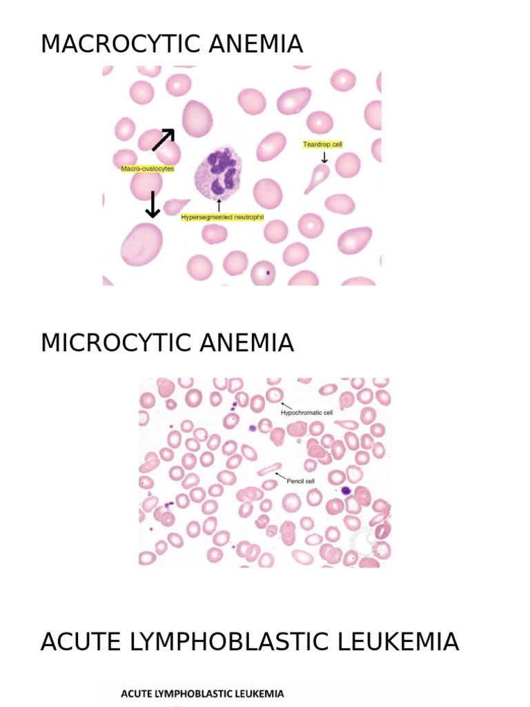Bds Record Microscopic Pictures | PDF