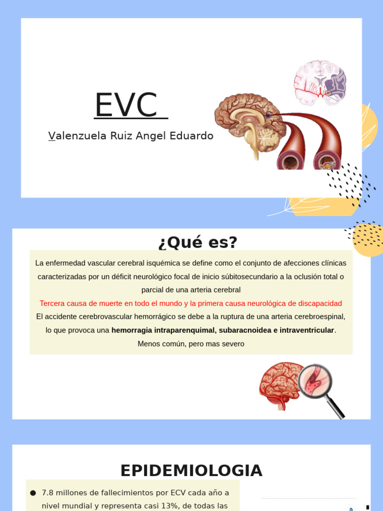 EVC Exposición | PDF | Carrera | Medicina CLINICA