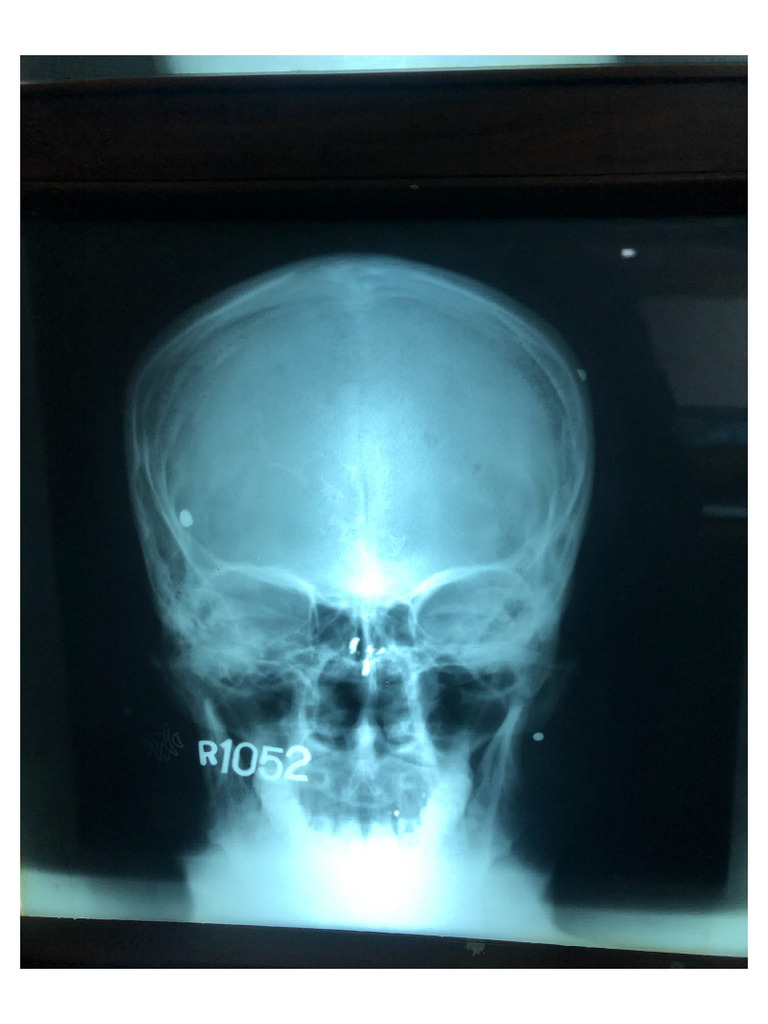 Ospe Material For Forensic Practical Exam | PDF