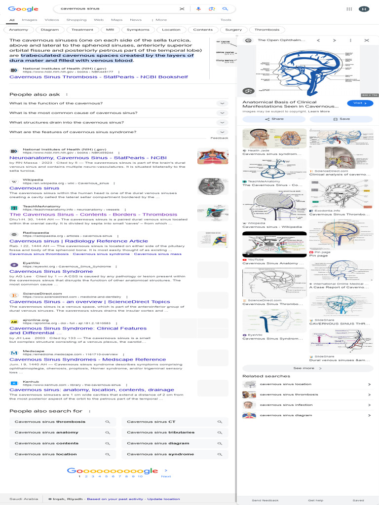 Cavernous Sinus Anatomy and Thrombosis | PDF | Human Head And Neck ...