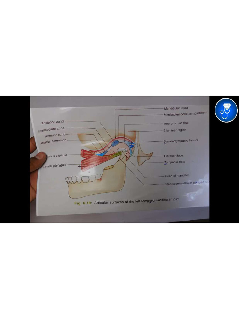 TMJ 3 | PDF