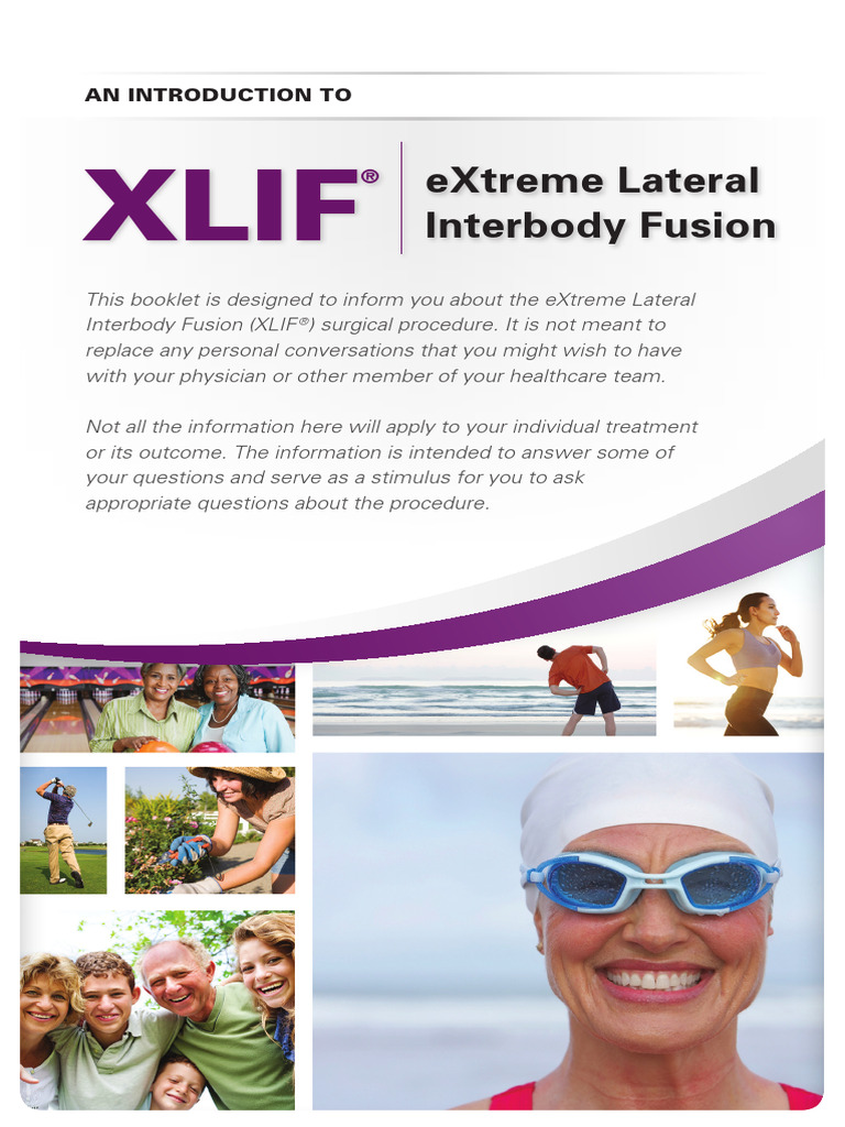 Understanding XLIF Surgery Benefits | PDF | Vertebra | Scoliosis