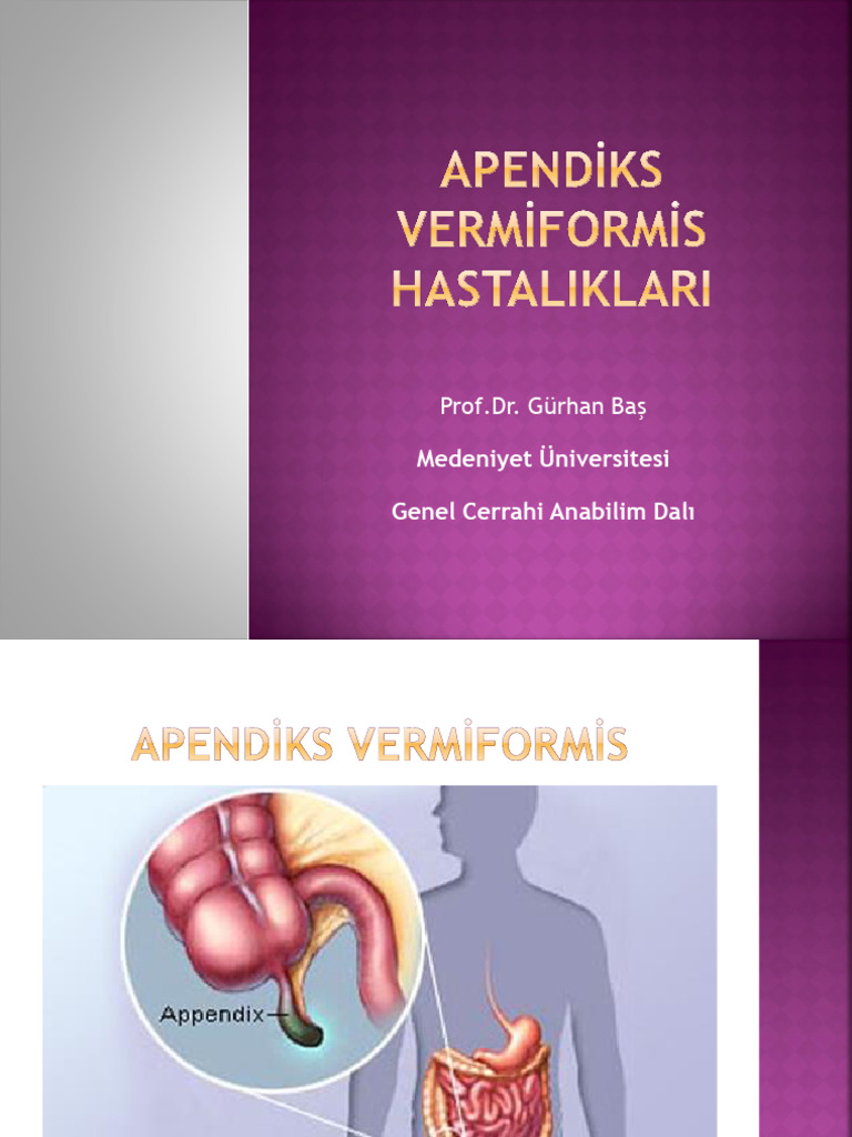 33.Apendiks-Vermiformis-Hastalıkları-1 | PDF
