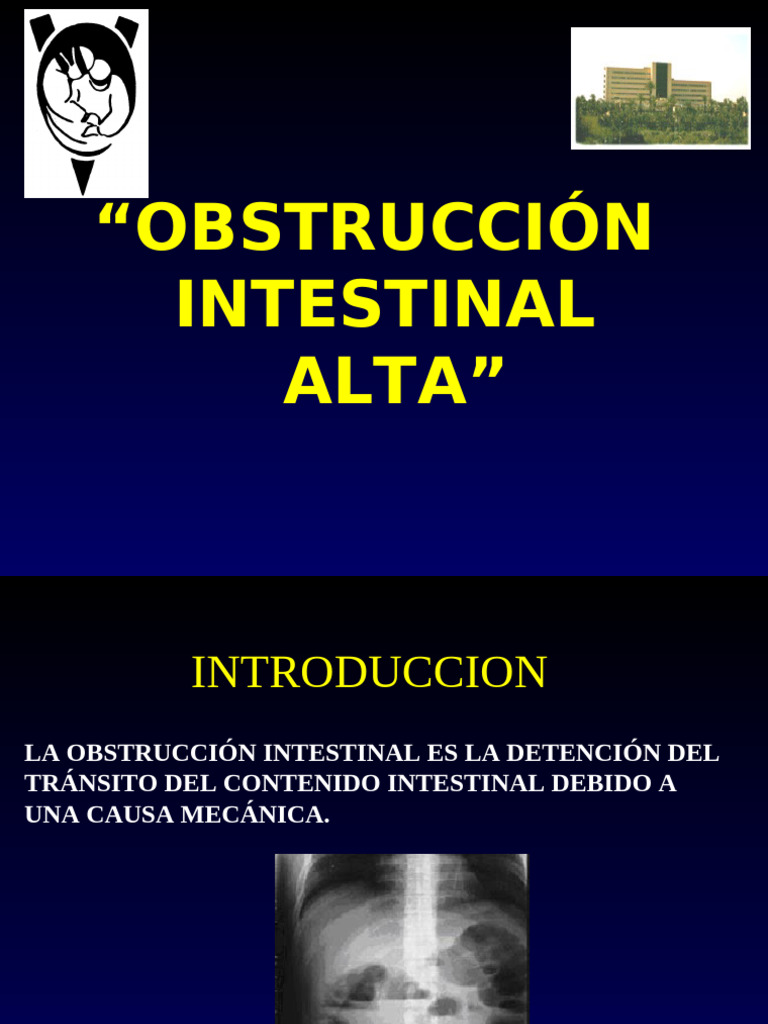 Obstrucción Intestinal Alta: Causas y Manejo | PDF | Tracto ...