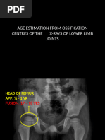 Bone Age Specific X-Rays | PDF
