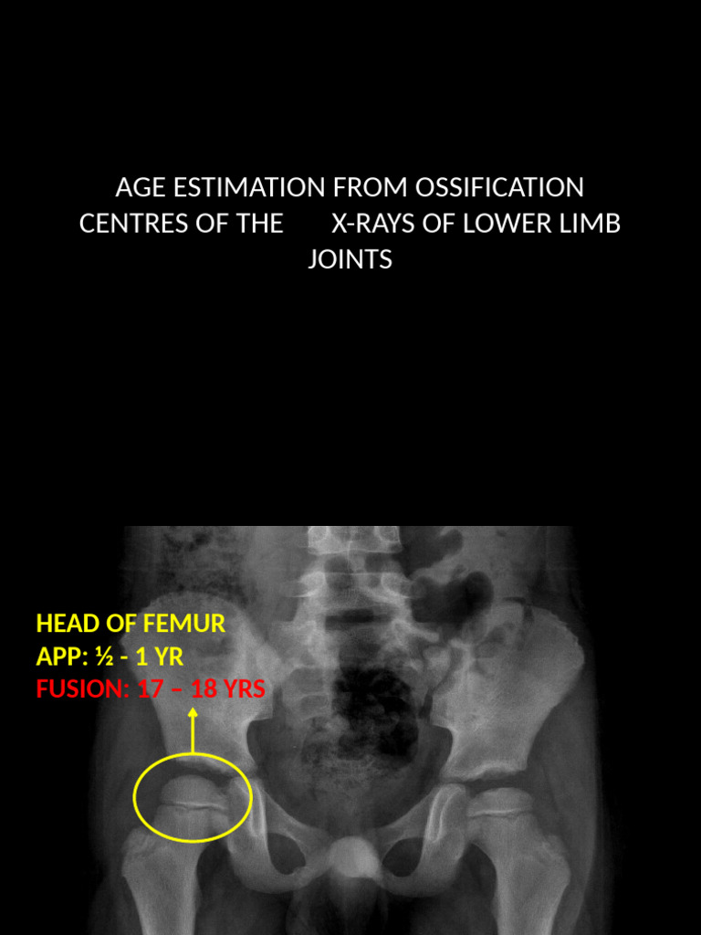 Lower Limb X-Ray | PDF | Human Leg | Lower Limb Anatomy