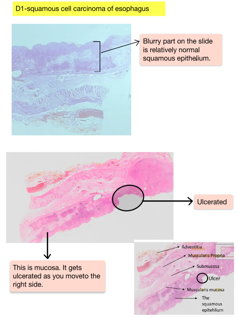 Pathology of The Stomach Lab 1-2 | PDF | Epithelium | Esophagus