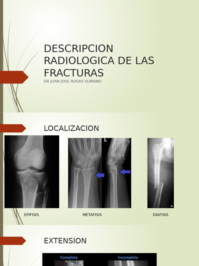 Descripcion Radiologica De Las Fracturas Pdf
